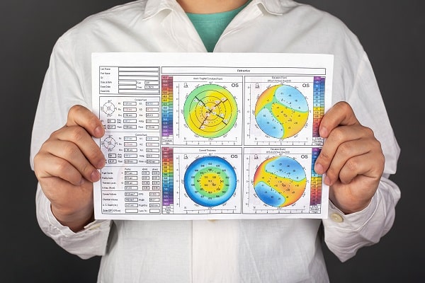 Topografia Corneana: o que é, para que serve e como funciona?
